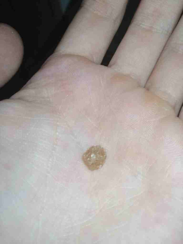 Imagepipe 7 — Postimages