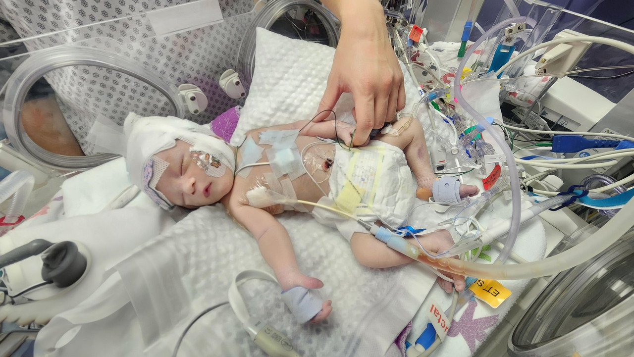 fix pic mouth clean — Postimages