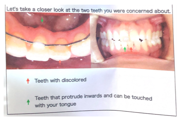 2nd Opinion Needed [X-Ray & CT Scans included]. Treatment for ...