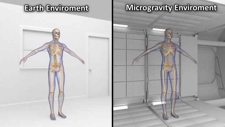 Gravity: Decreased Bone Mass In Astronauts – Sopriza