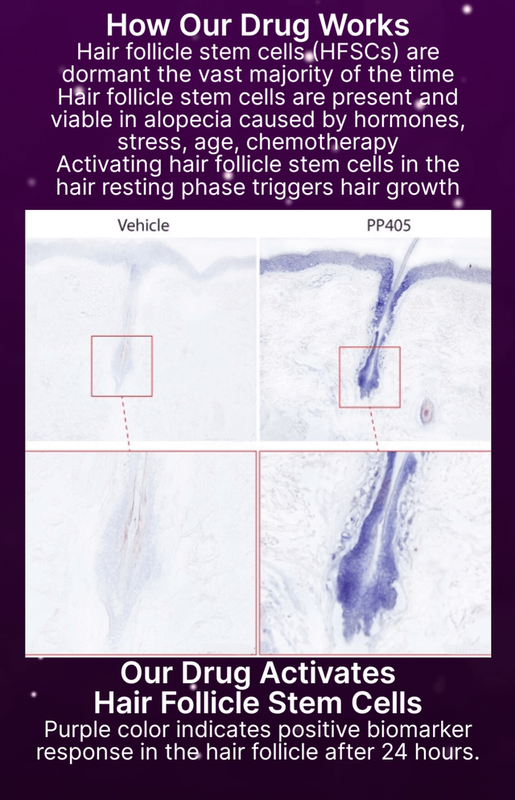 Scoperta PP405, la molecola che riattiva la crescita dei capelli