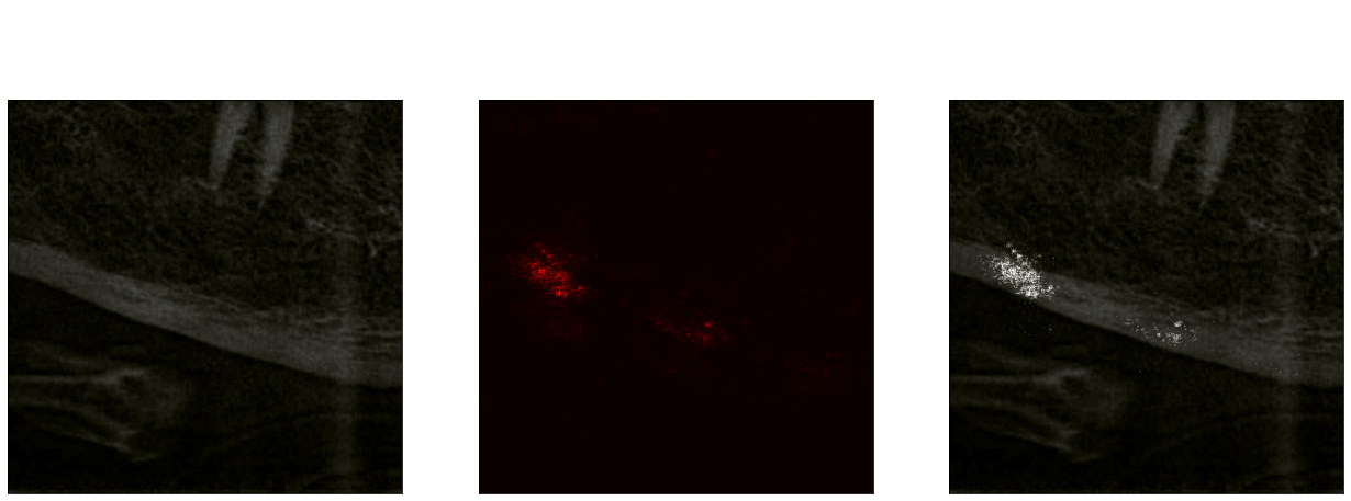 Deep-Learning-for-Bone-Health-Classification-through-X-ray-Imaging ...