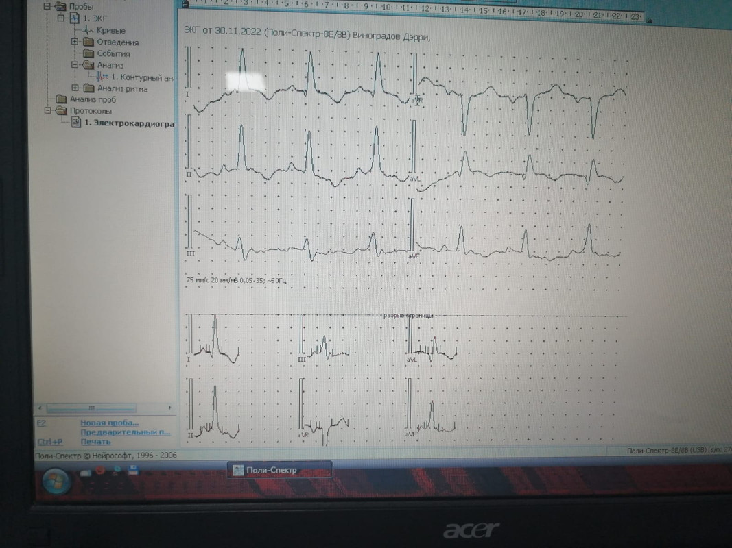 ffd6fdfd 3dc1 45b9 8e02 b1fff1ee4b46 — Postimages