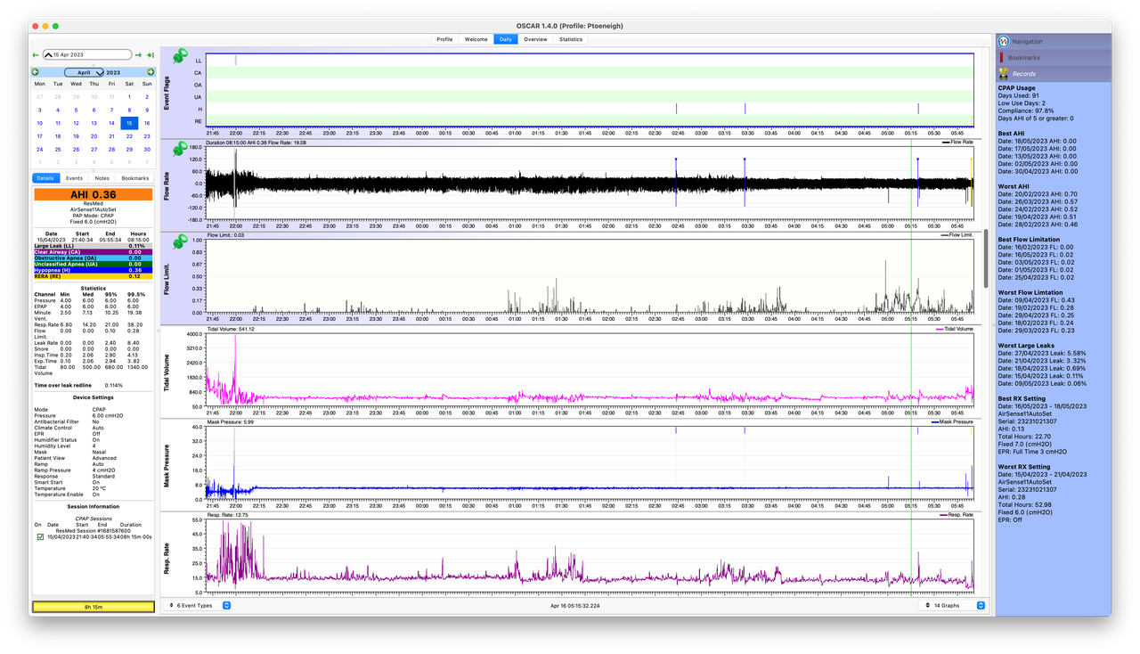 APR15 P6 EPR OFF — Postimages