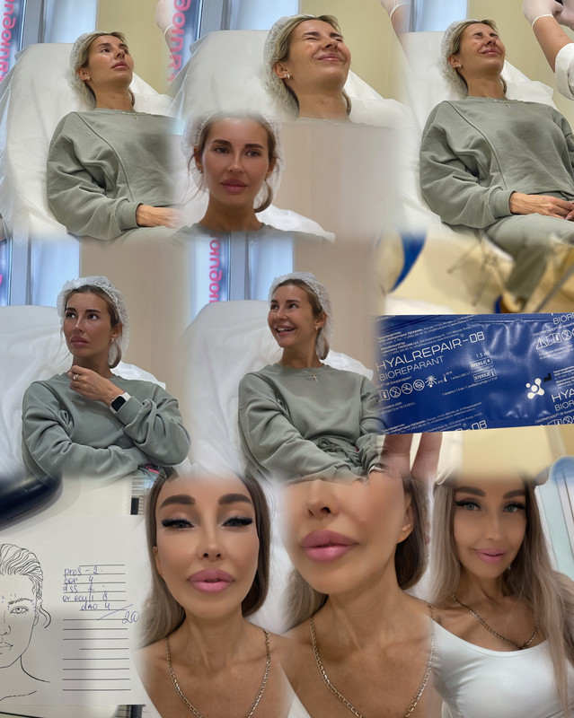 photo output — Postimages