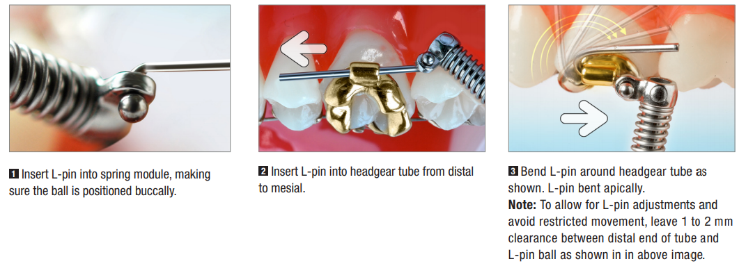 Buy 3M Unitek Forsus Fatigue Resistant Device L-Pin Module At Best ...