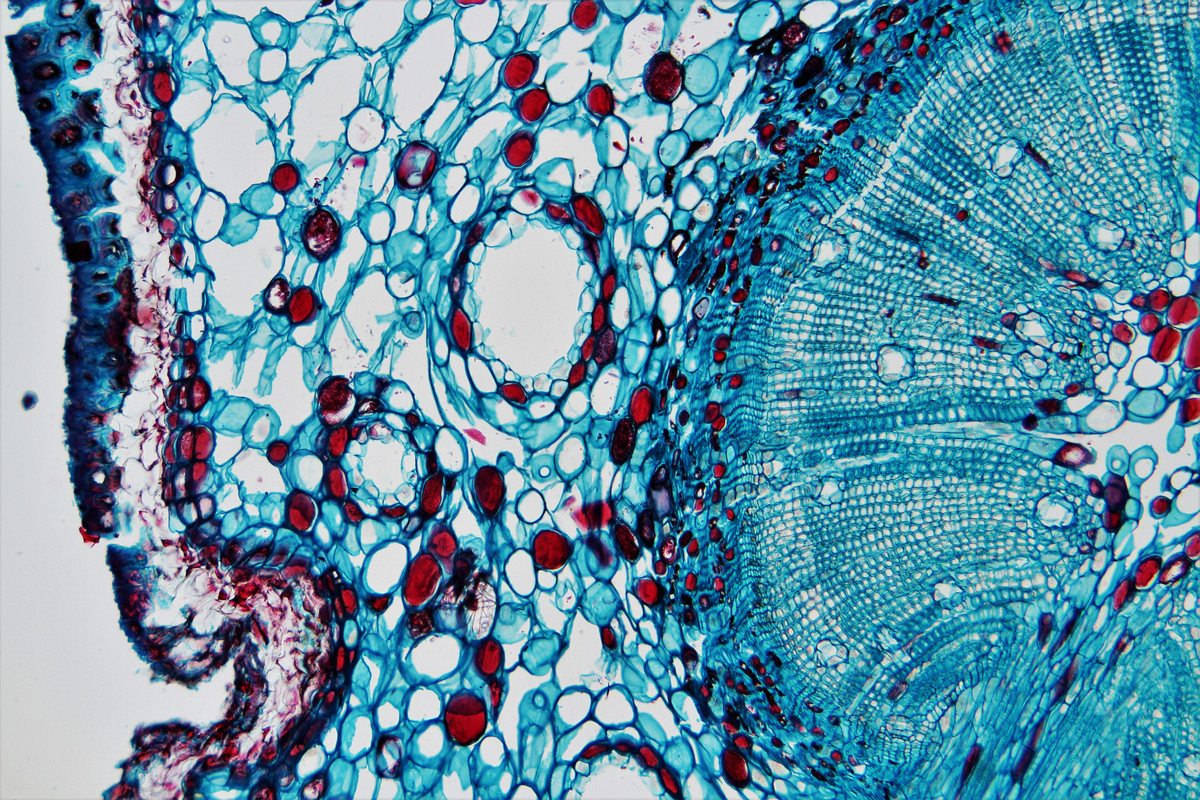 IMG 8161 — Postimages