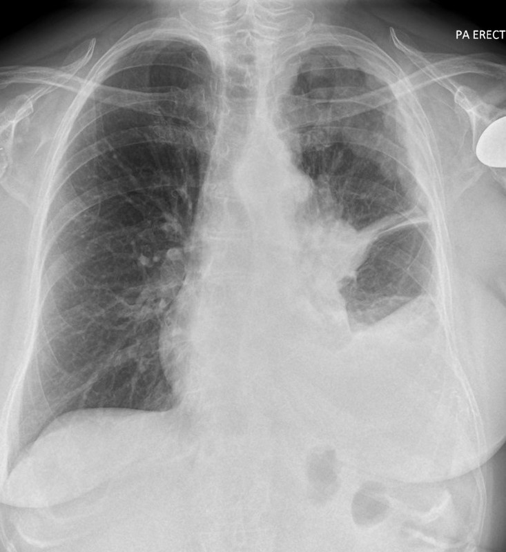 Case 3 — Postimages