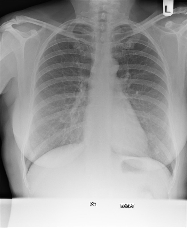 Case 4 prev — Postimages