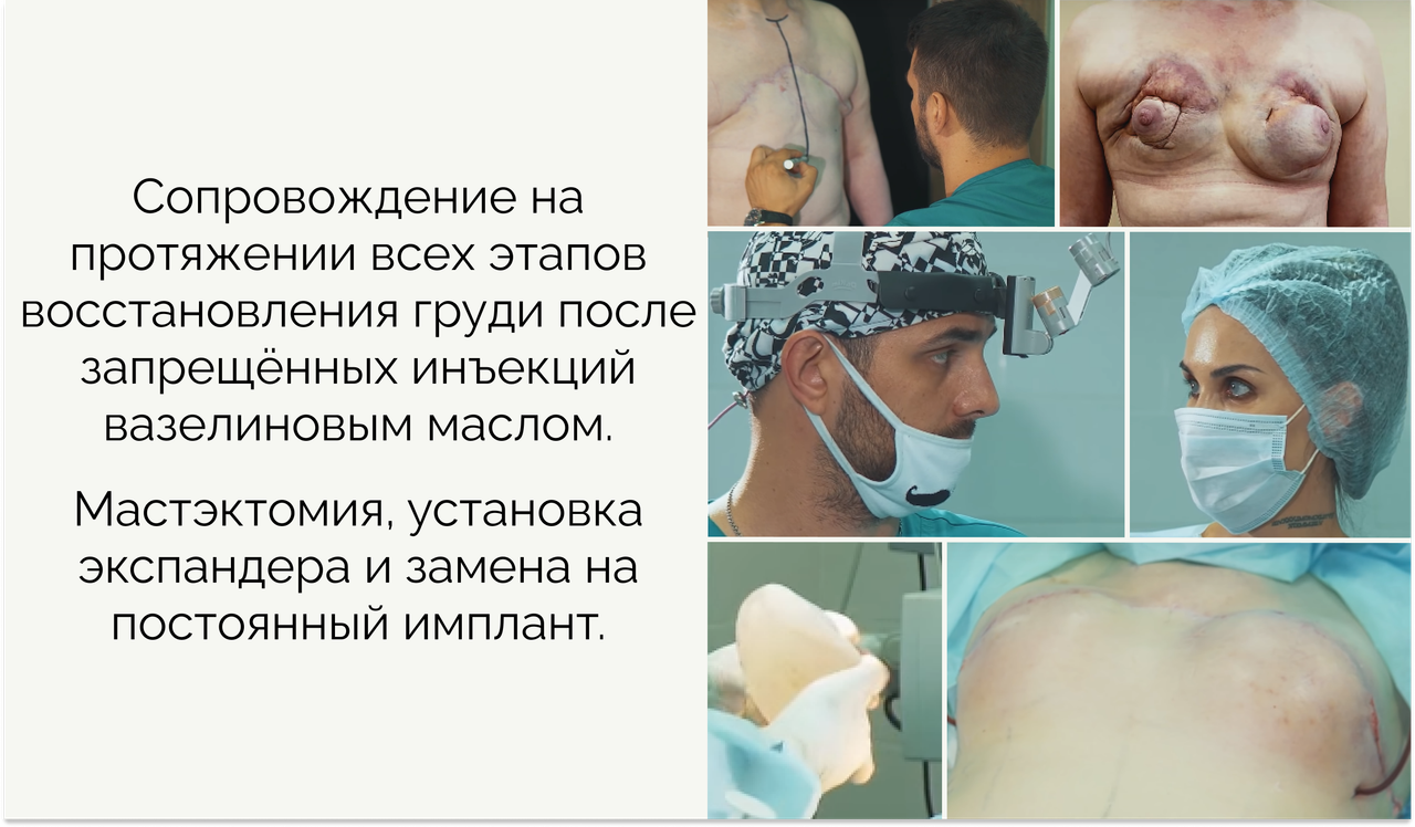 case 2 — Postimages