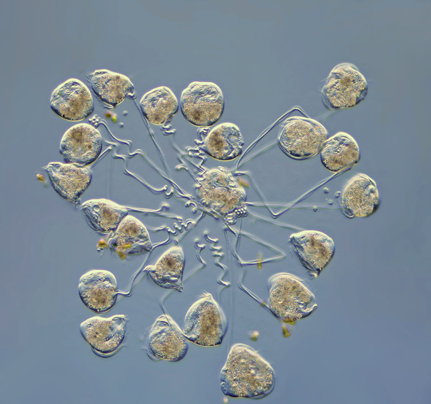 Vorticella 30 (ev) picta Kolonie DIK 25 — Postimages