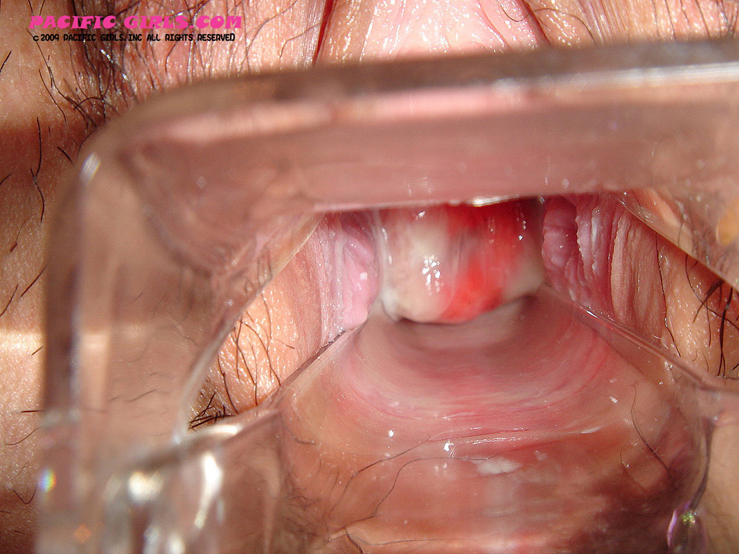 akie 428 — Postimages