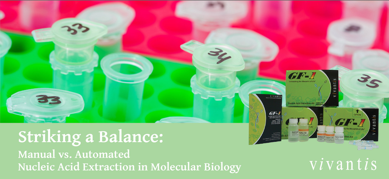 VIBLOG: Striking a Balance: Manual vs. Automated Nucleic Acid ...