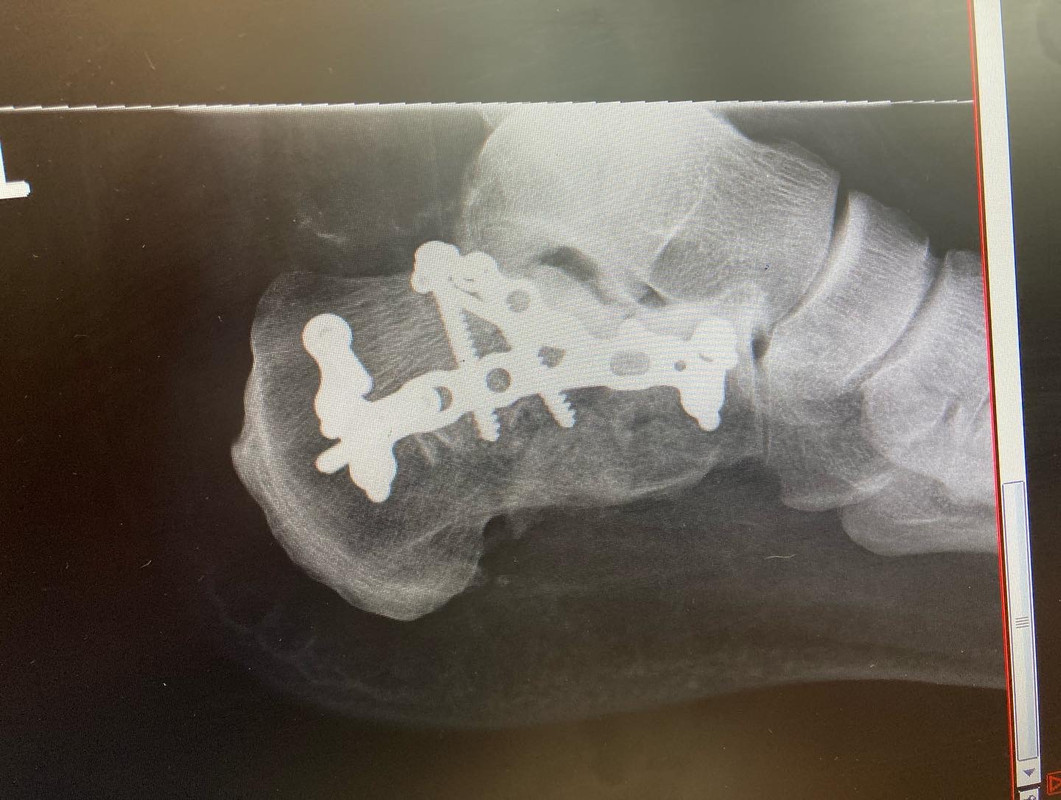 F802 A014 D15 E 44 F3 9144 96 CC27 C53434 — Postimages