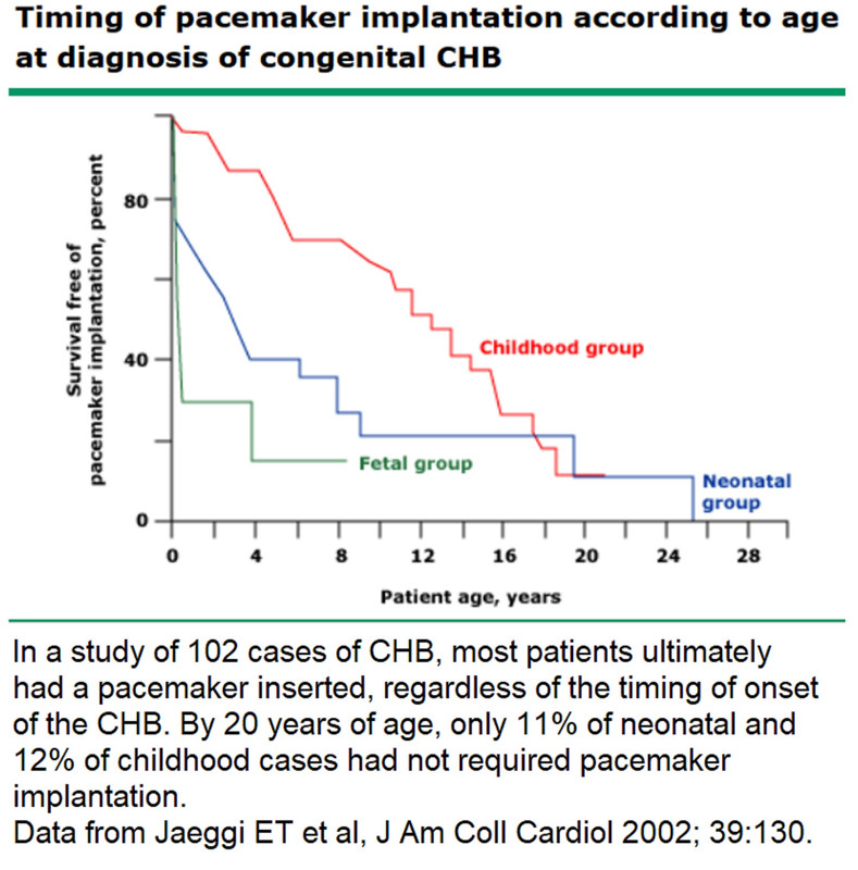 Time of pacemaker implantation CHB — Postimages
