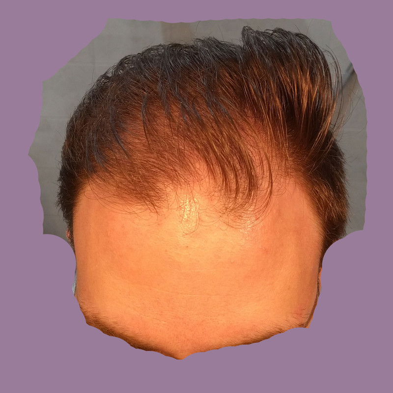 2 front — Postimages