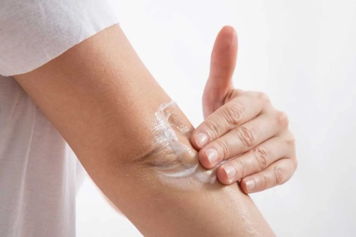 ¿Cuál es el remedio casero para eliminar las manchas negras de los codos? - Imperio Noticias