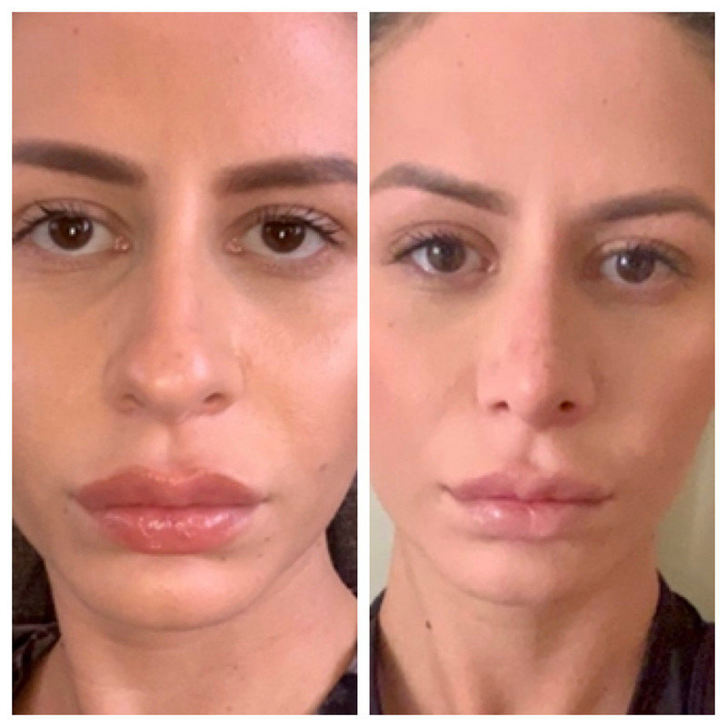 01 B1 E0 B2 1 A6 C 469 F AE43 D2 D984 DDF10 C — Postimages