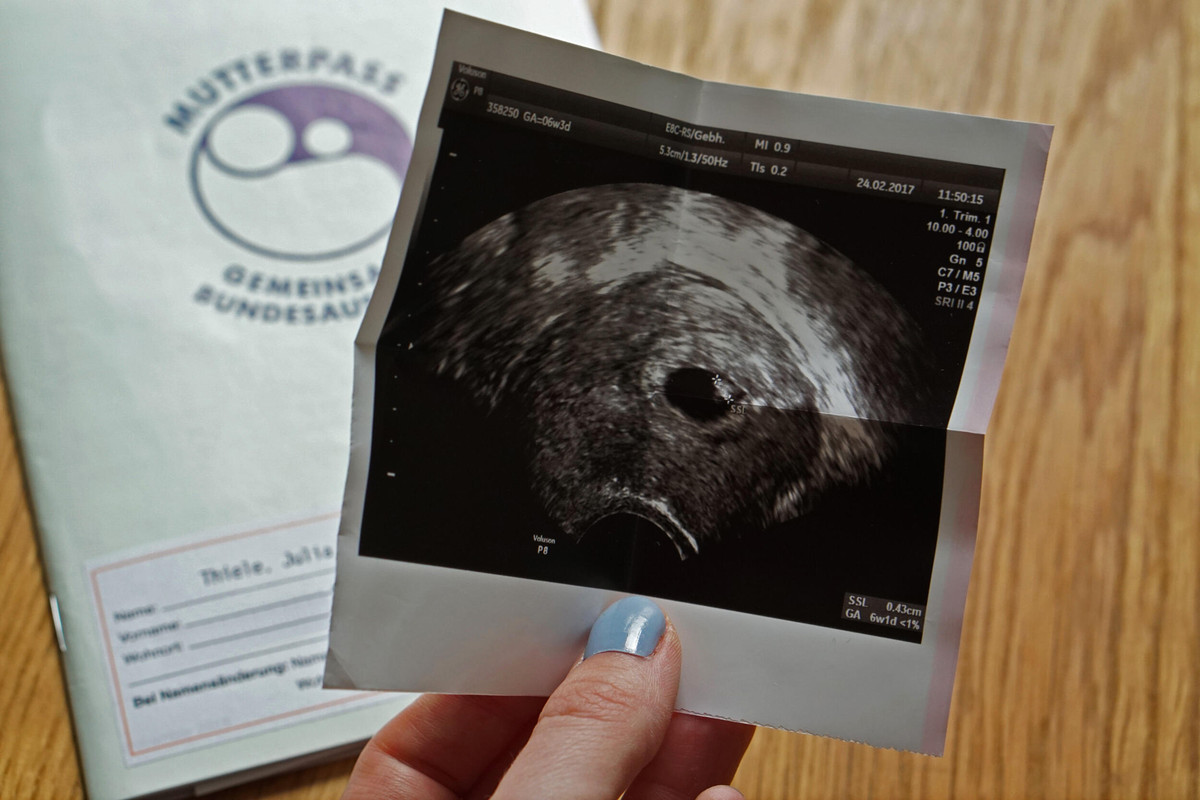 Ultraschall Title — Postimages