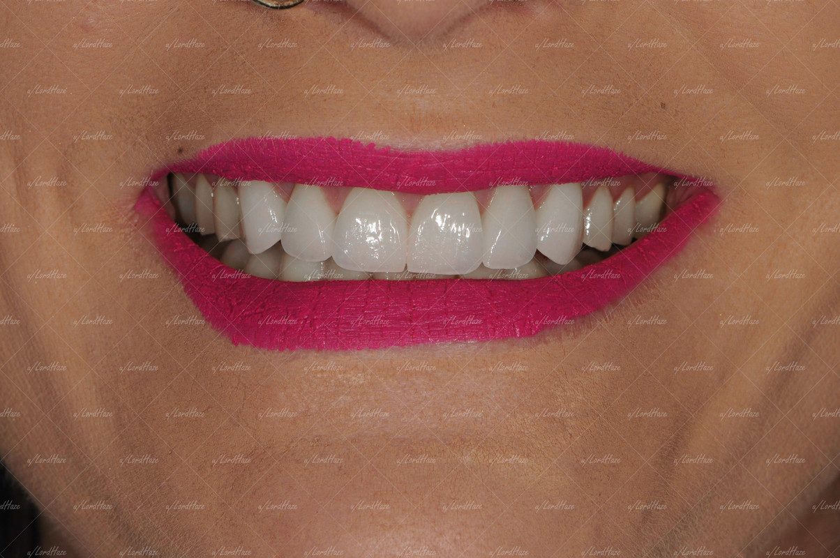 3n19vrkzc2p71 edit — Postimages