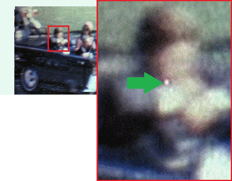 The Zapruder film used in Oliver Stone's JFK movie depicts a frontal ...