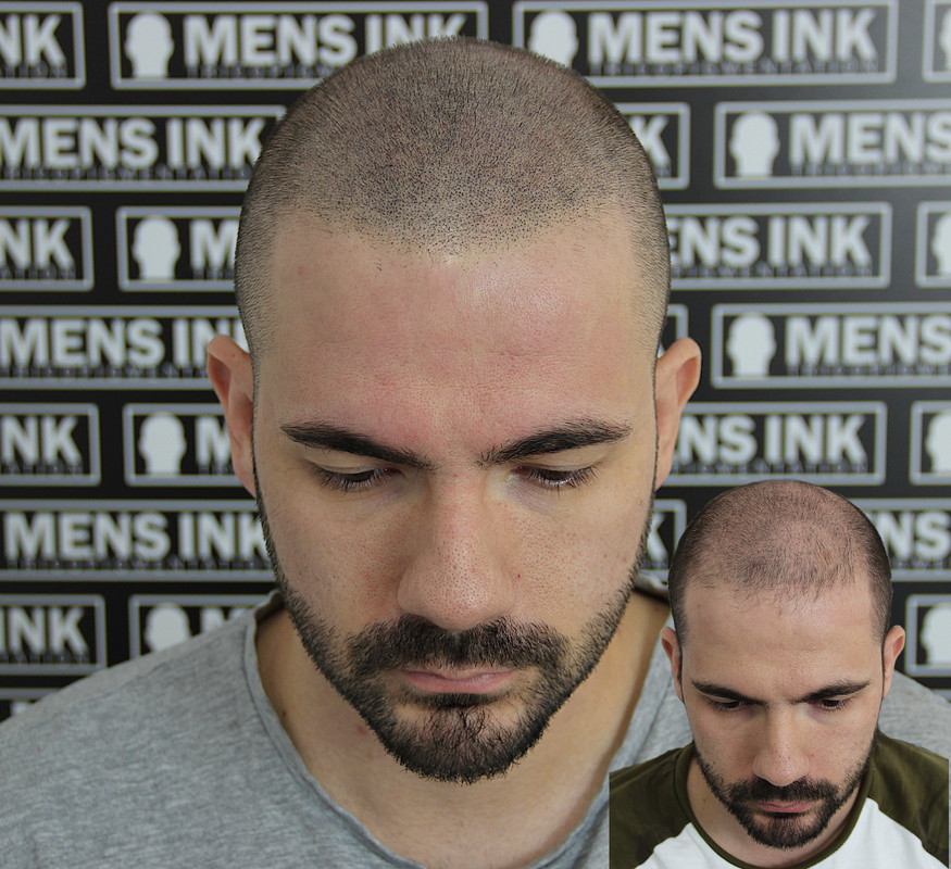 Men's Ink - 30/08/23 Tricopigmentation effet de densité avec des ...
