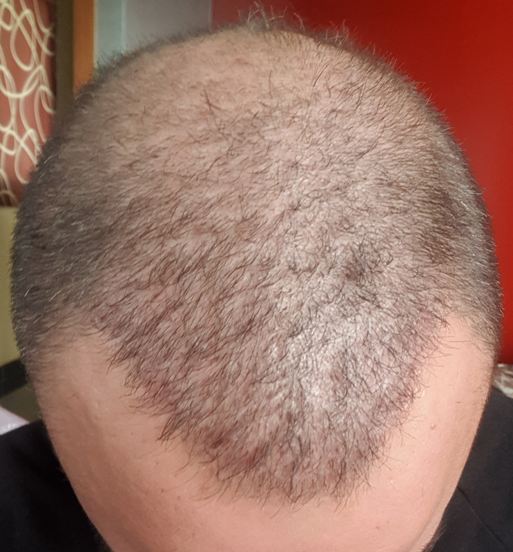 Point Blur Nov212020 102542 — Postimages