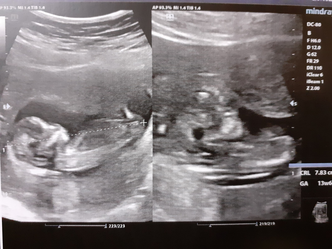 Can't confirm the sex, need help : r/CautiousBB