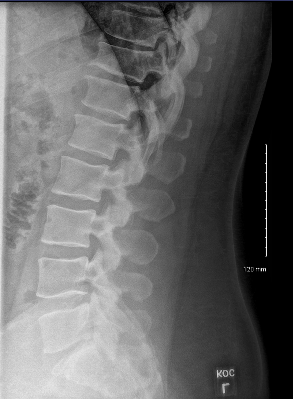 Capture Capture — Postimages