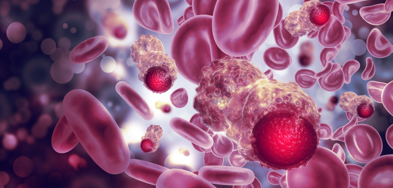 GitHub - NimaPourmoradi/Blood_Cell_Cancer_Pytorch: Blood cell cancer detection by pytorch