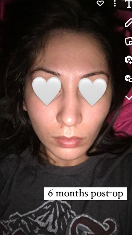 25285 E64 43 C6 4 FAE 8644 C16 D738365 DB — Postimages