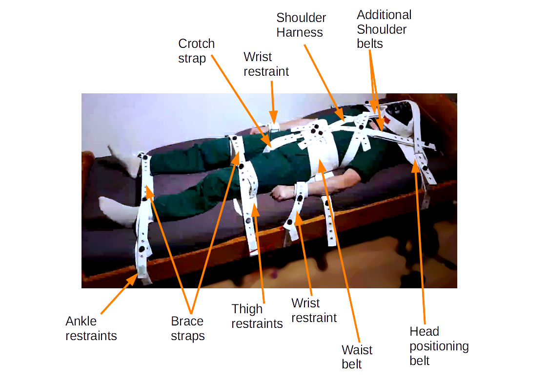 The Segufix thread - www.BoundAnna.com