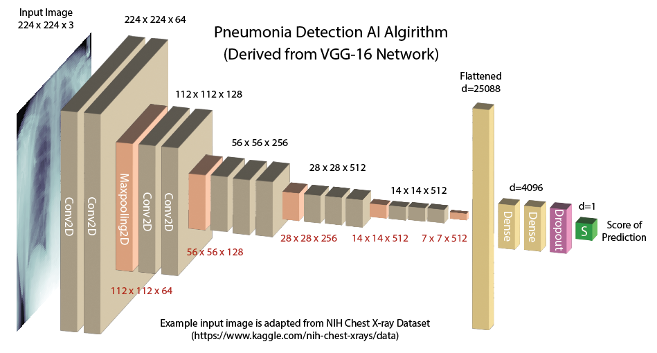 VGG16 architecture — Postimages