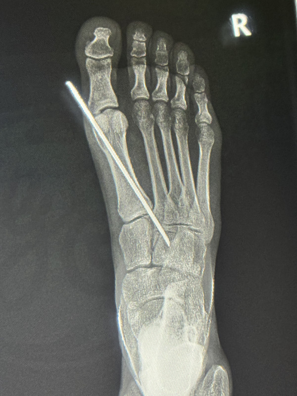 IMG 1534 — Postimages