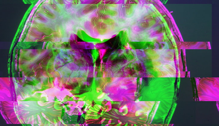 Meningoencephalitis - Limbo | Royal Road