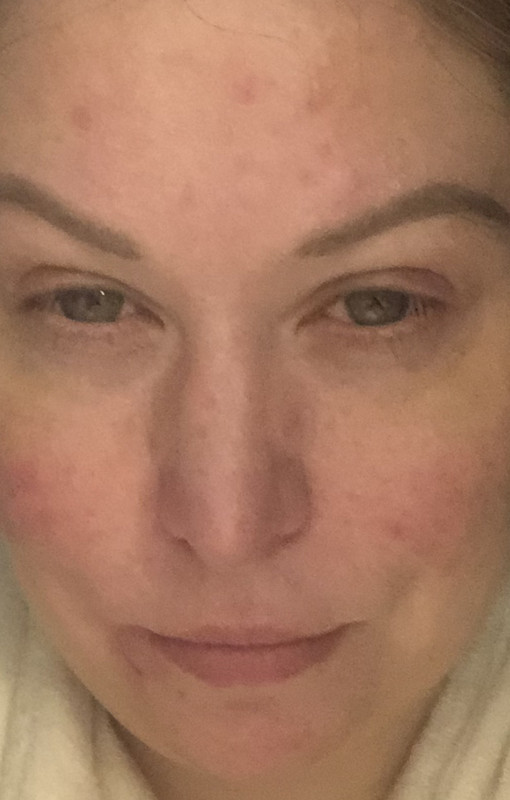 B67 E0968 8833 418 B 86 BC 2 C72 FD41 BDFC — Postimages