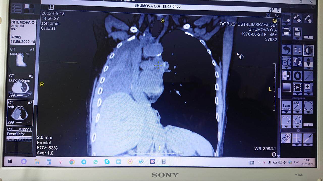 DSC 0154 — Postimages