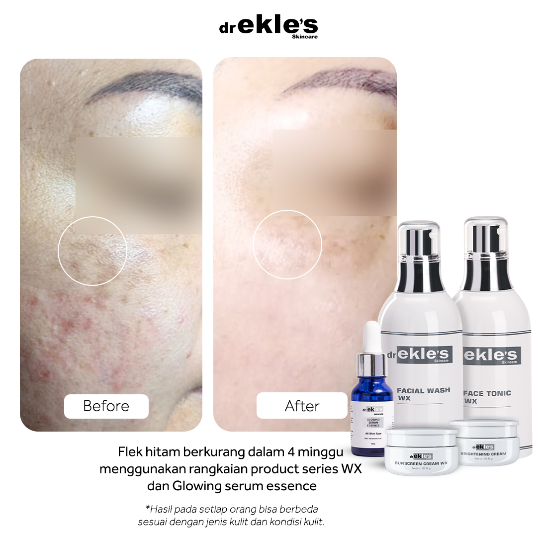 Before after shopee series wx dan glowing serum 120 ml — Postimages