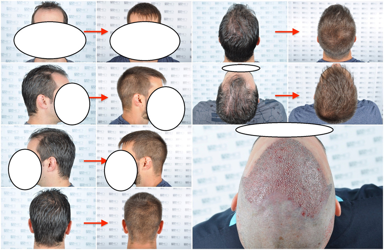 16 D1 — Postimages