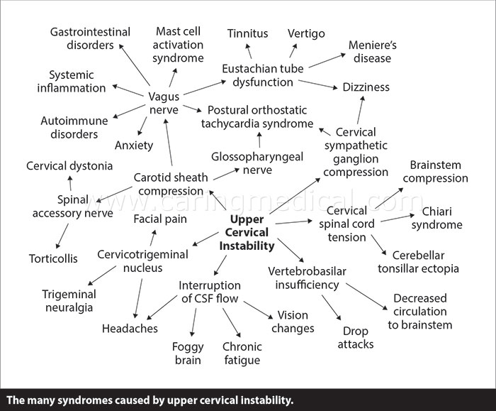 Is this diagram about cervical instability accurate? : r/medical