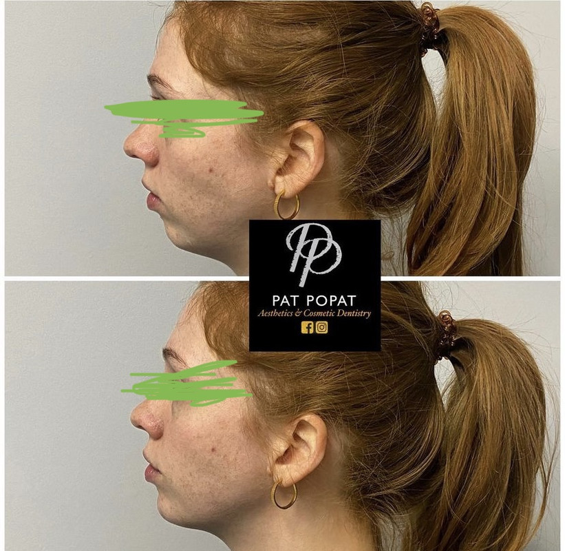 5 B1 A0666 64 C0 4 B97 87 E9 83818 F25 C5 CB — Postimages