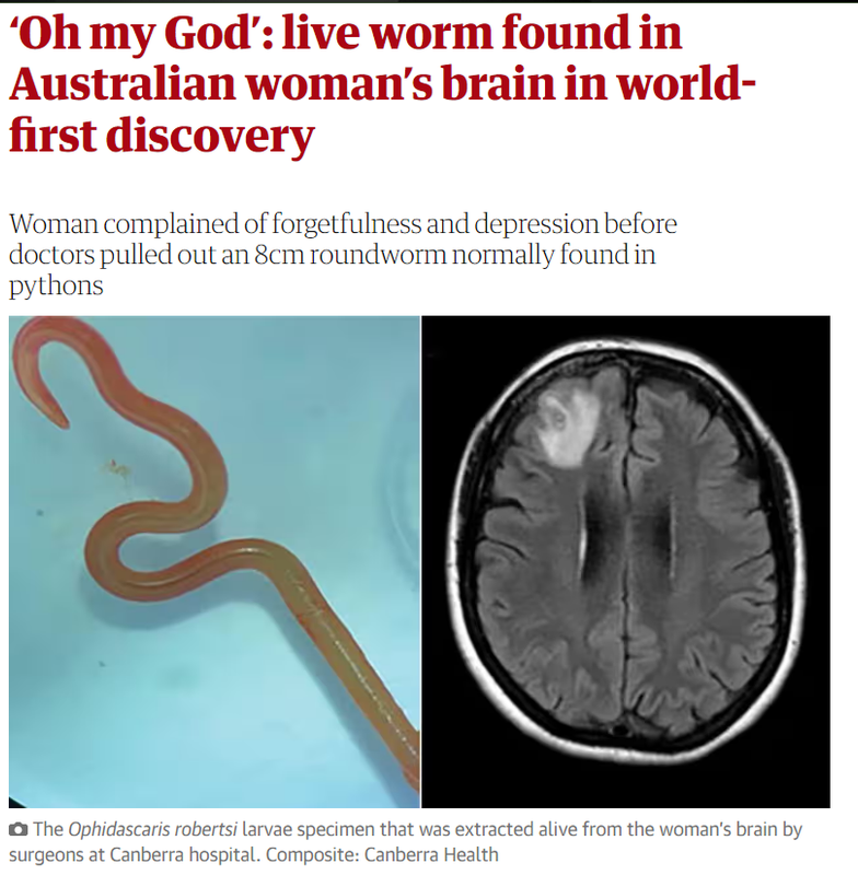 Live 8cm roundworm found in Australian woman's brain for the first time ...