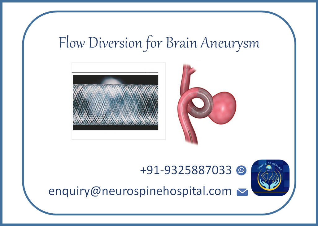 How Flow Diverter for Brain Aneurysm in India benefits many patients ...