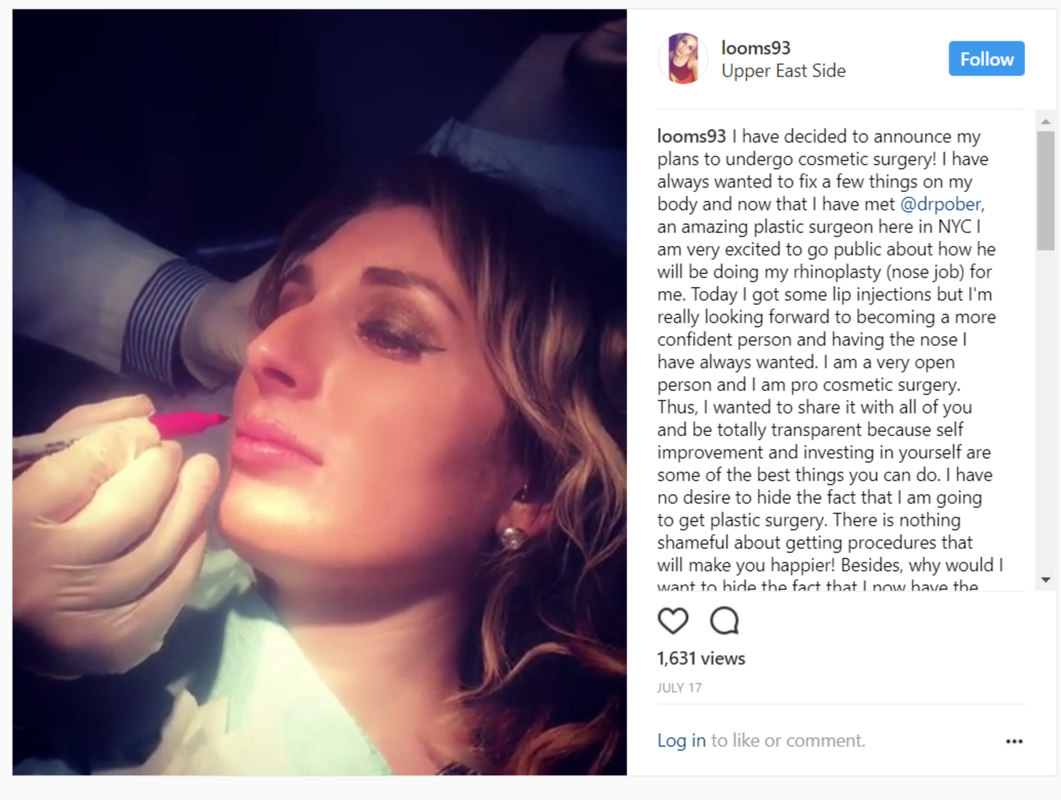 laura loomer nose job4 — Postimages