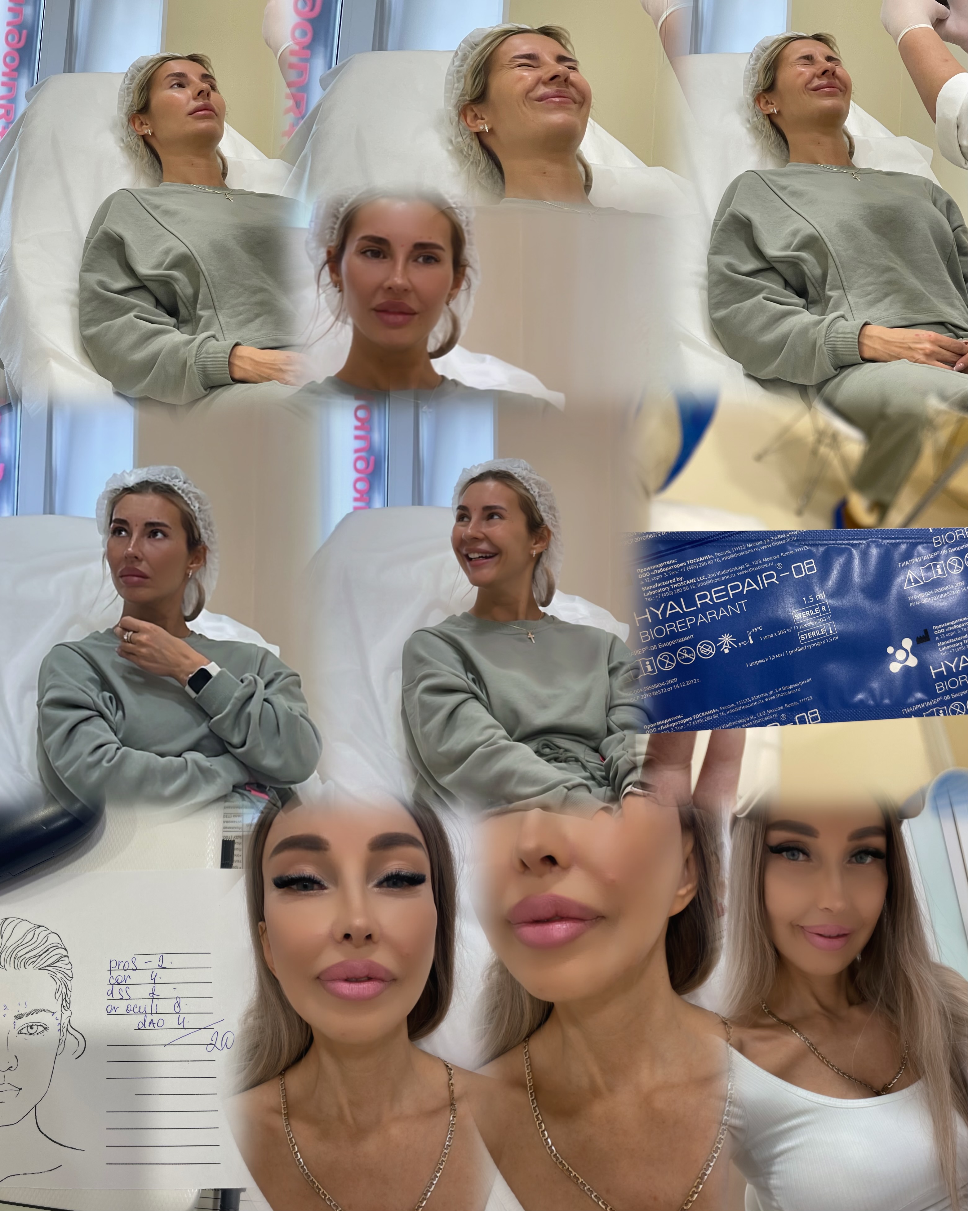 photo output — Postimages