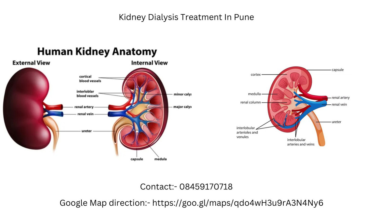 Kidney Dialysis Treatment In Pune Google Map direction https goo gl ...