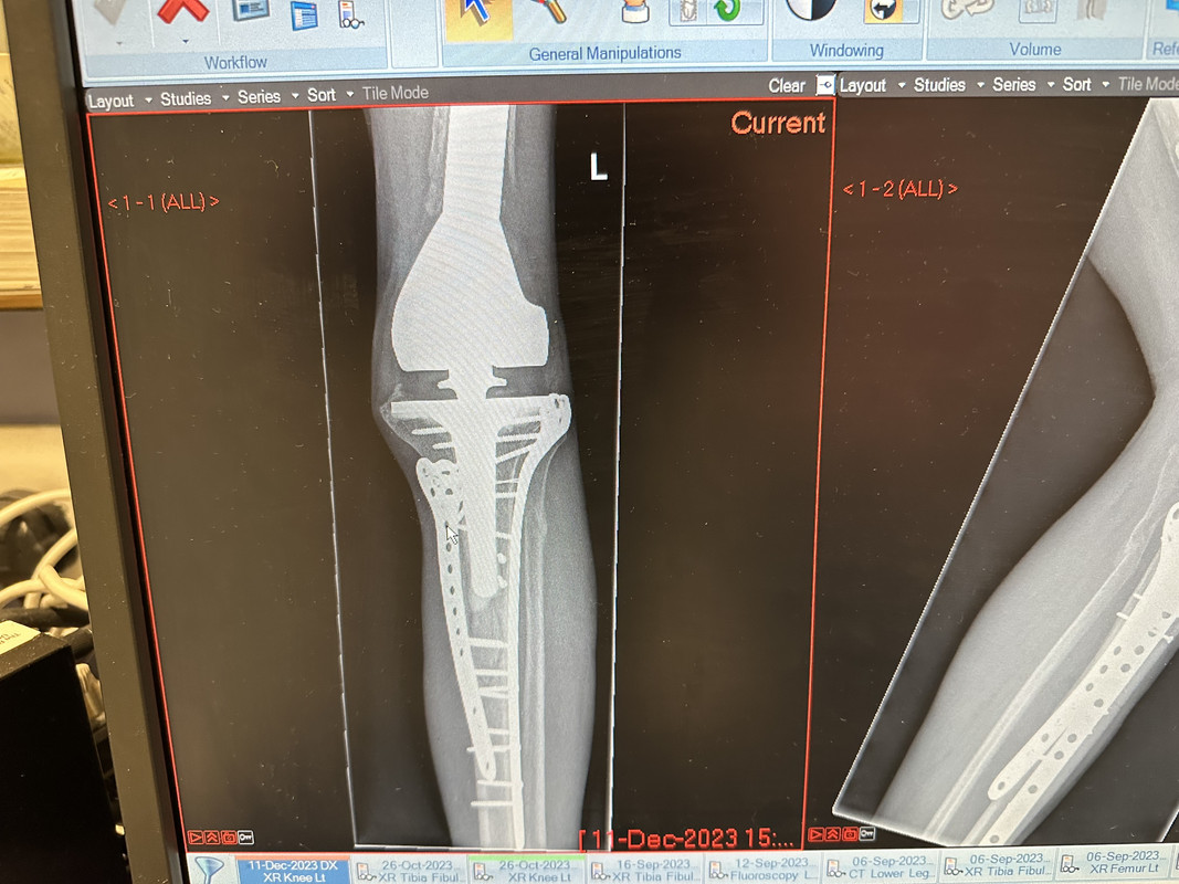 IMG 1016 — Postimages