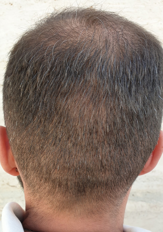 Point Blur Mar212021 235157 — Postimages