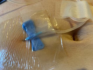 DIY IV Solution | Survivalist Forum