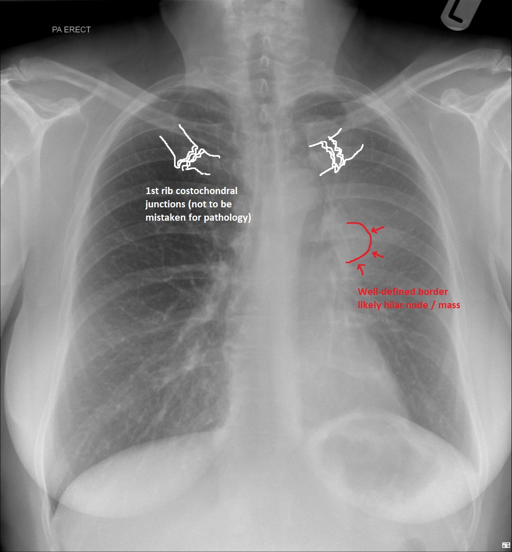 Case 4 annotated2 — Postimages